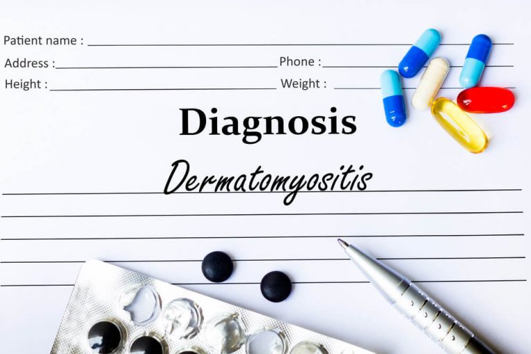 JUVENILE DERMATOMYOSITIS; THE CAUSE AND SYMPTOMS PT 2