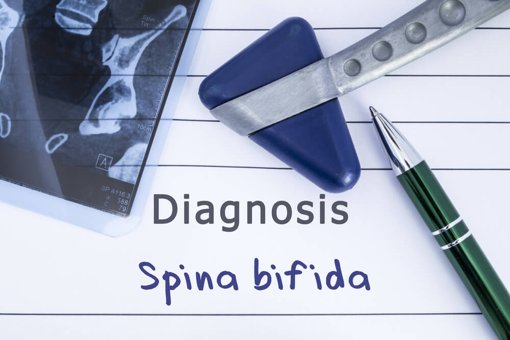 THINGS TO KNOW ABOUT THE SPINA BIFIDA DISORDER PT 1
