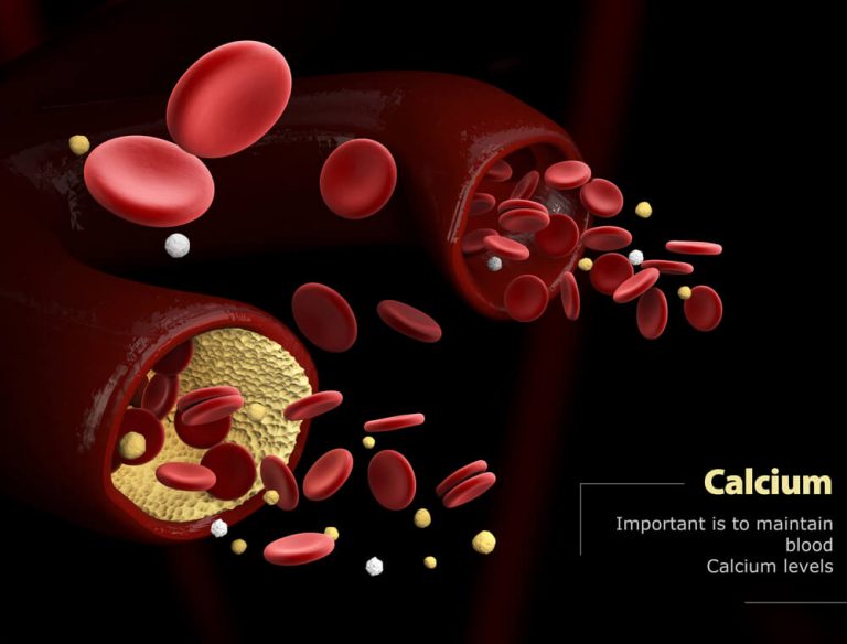 EVERYTHING YOU NEED TO KNOW ABOUT CALCIPHYLAXIS