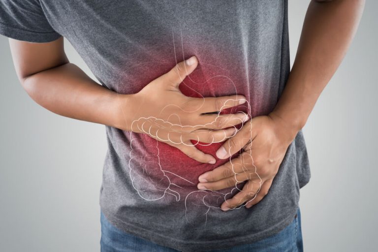 THE TREATMENT OPTIONS FOR ULCERATIVE COLITIS