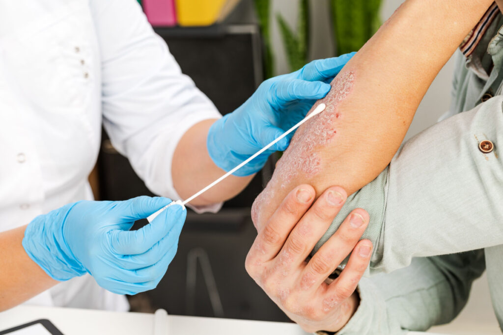 Understanding Different Types Of Skin Infections