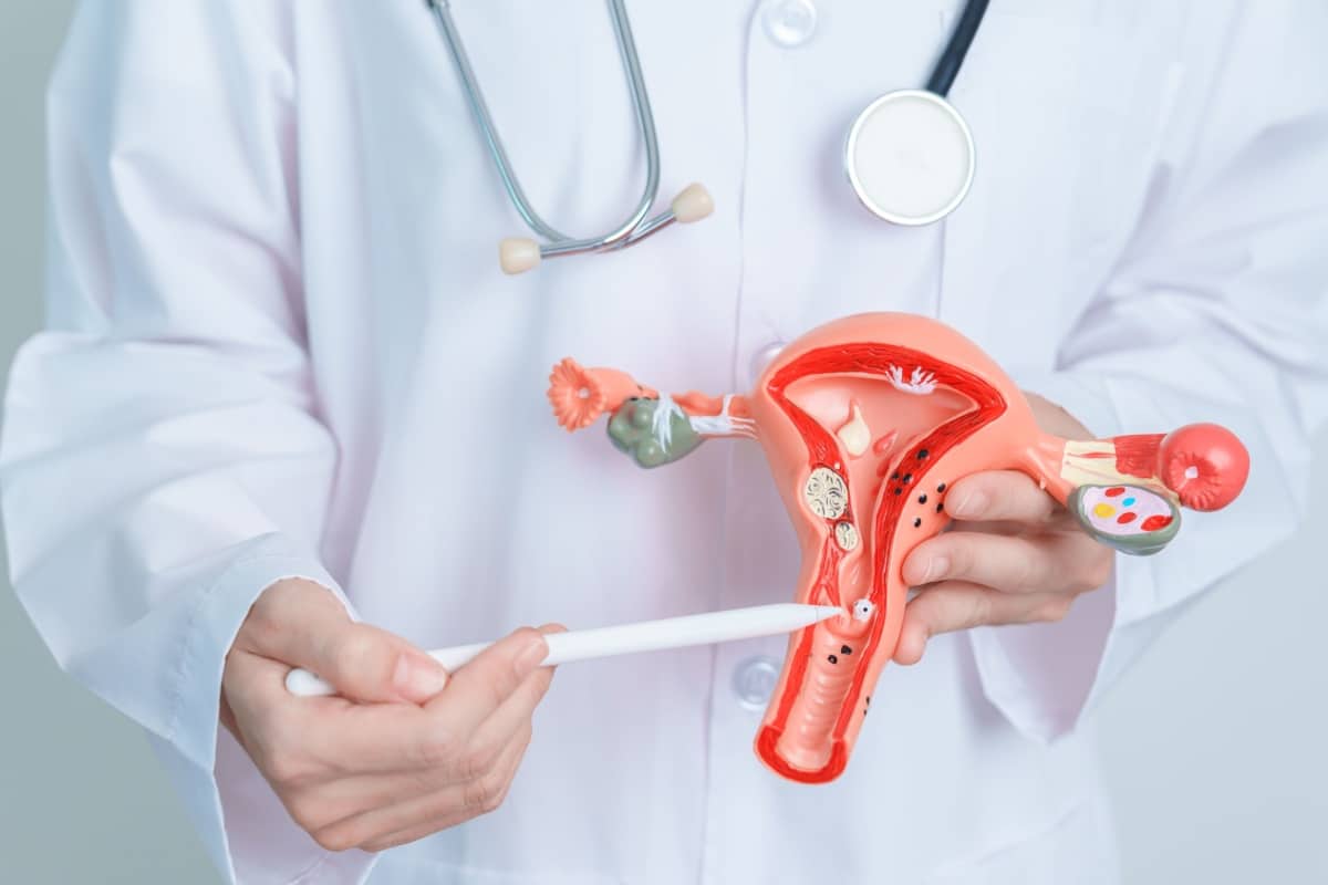 Managing PCOS: Symptoms, Diagnosis, and Treatment Options - CCCHC